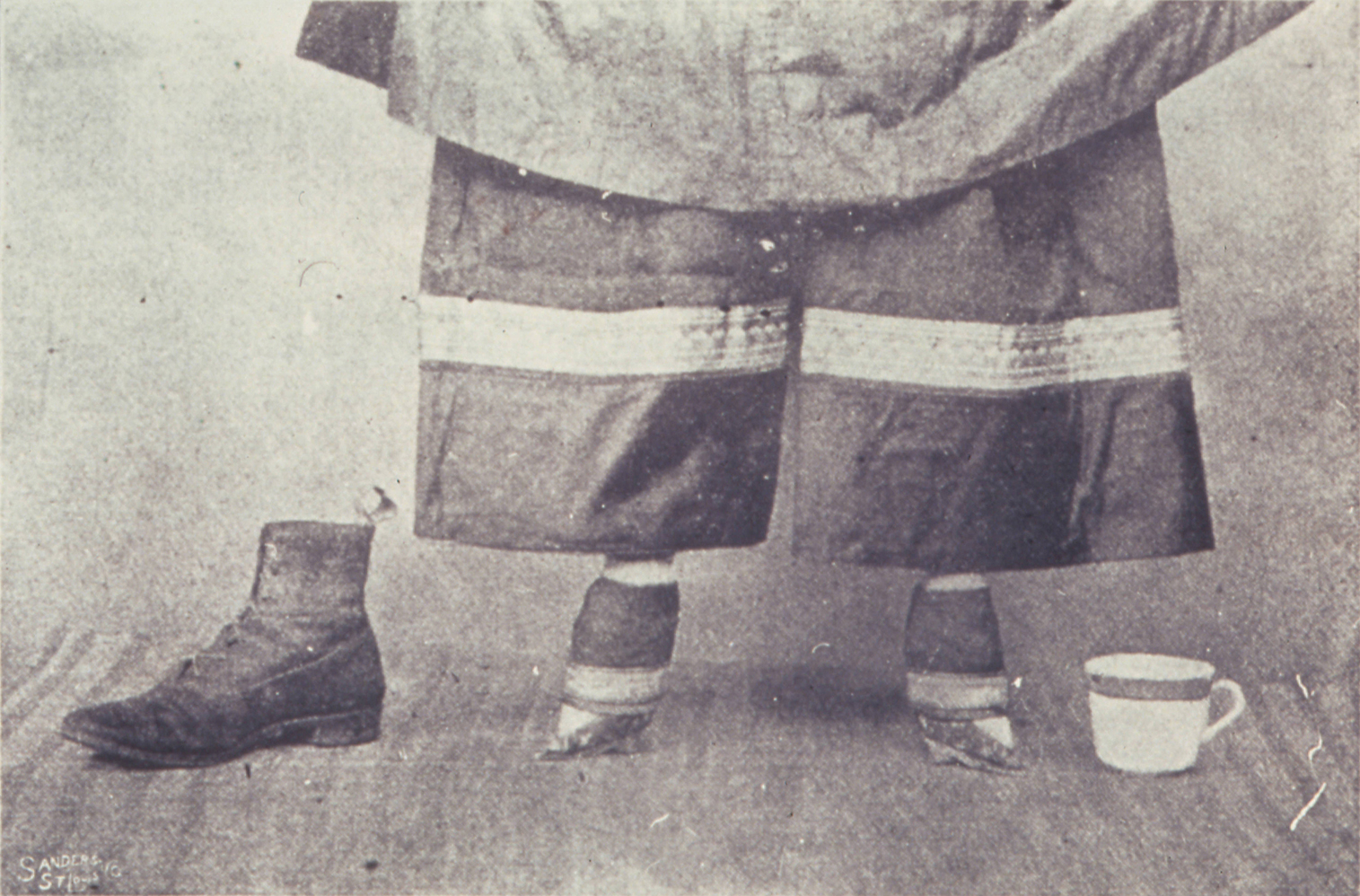 Leveled Reading Passage: Chinese Foot Binding (Easy) | RIF.org